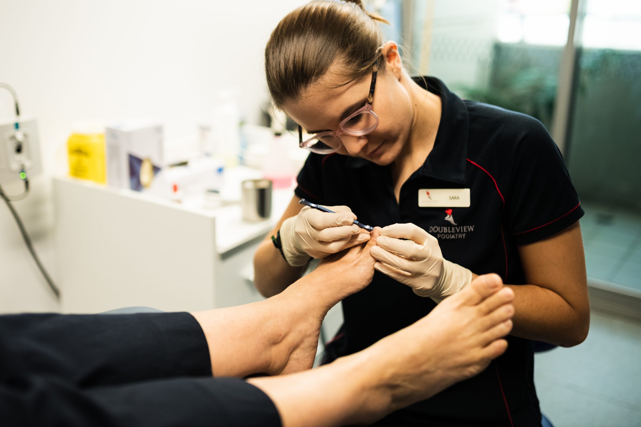 Ingrown Toenails - How to treat them - Doubleview Podiatry
